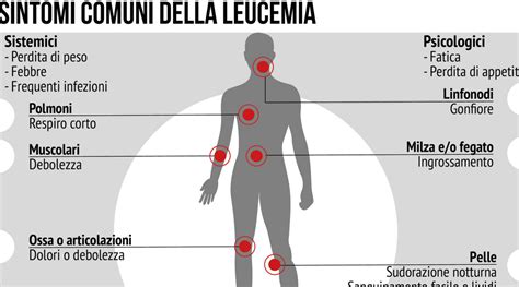 Leucemia I Sintomi Più Comuni Della Malattia