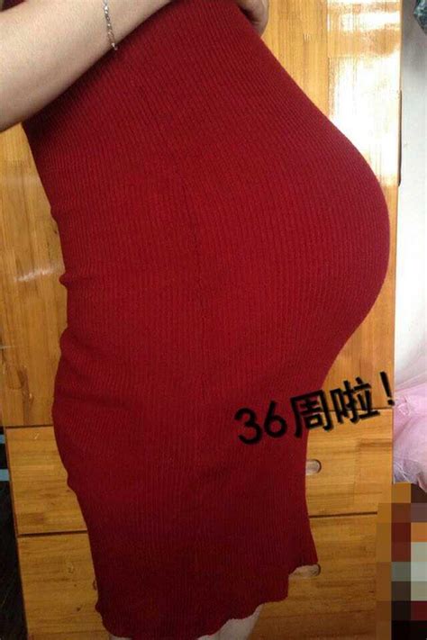 雙腎盂分離是男寶？來看看我的男寶症狀，百接白靈哦！ 每日頭條