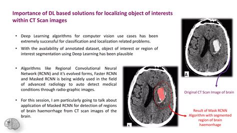 Application of Masked RCNN for segmentation of brain haemorrhage from Computed Tomography Images ...
