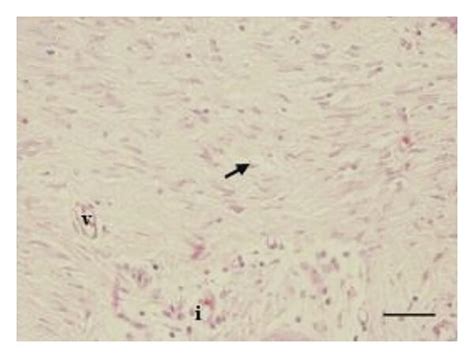 Photomicrographs Of The Dermal Part Of The Skin Wound Healing