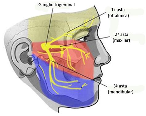 Trigemino Poliomielitis Y Postpoliomielitis Pinterest
