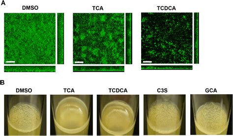 Bile Acids Balance The Gut Microbiome Protect The Body From Microbial