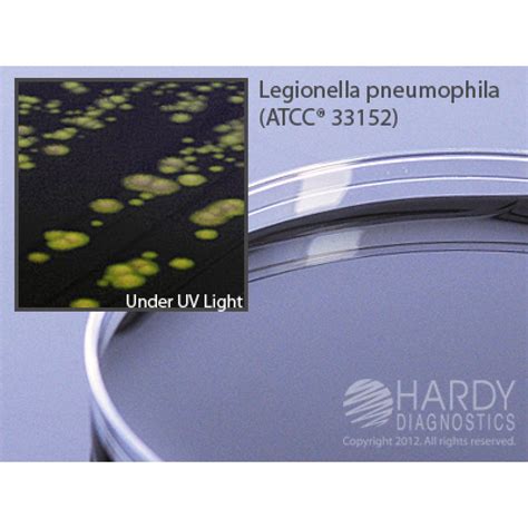 Hardy Diagnostic G08 Dry Culture Media Bcye Selective Agar W Cav