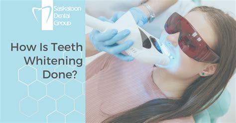 How Is Teeth Whitening Done Saskatoon Dental Group