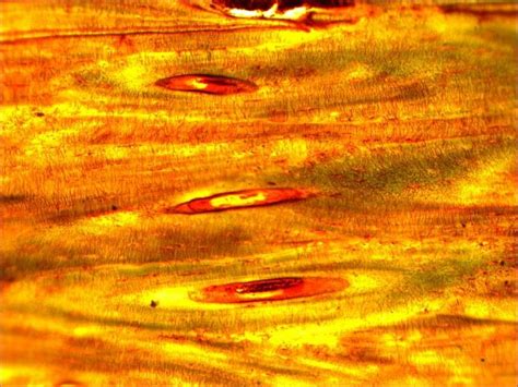 Tibia In Longitudinal Section Ob Lens ×40 Oc Lens ×10 The