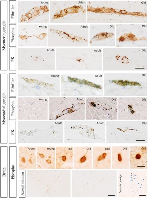 Ageing Promotes Pathological Alpha Synuclein Propagation And Autonomic Dysfunction In Wild Type