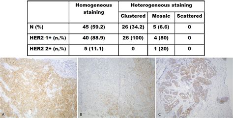 Her2 Low Breast Cancers Incidence Her2 Staining Patterns