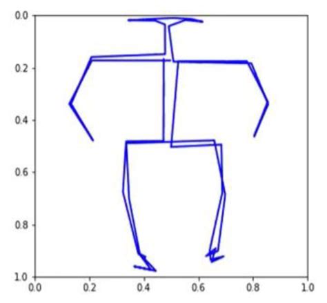 Jpm Free Full Text Using Efficientnet B7 Cnn Variational Auto