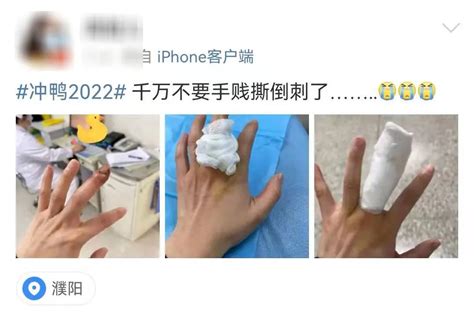 指甲旁边长倒刺是缺维生素 医院汇 丁香园