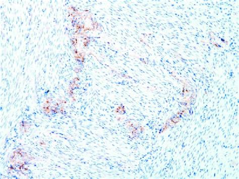Normal Structure Of Enteric Nerve Plexus In A Control Person By Download Scientific Diagram Normal Structure Of Enteric Nerve Plexus In A Control Person By Download Scientific Diagram