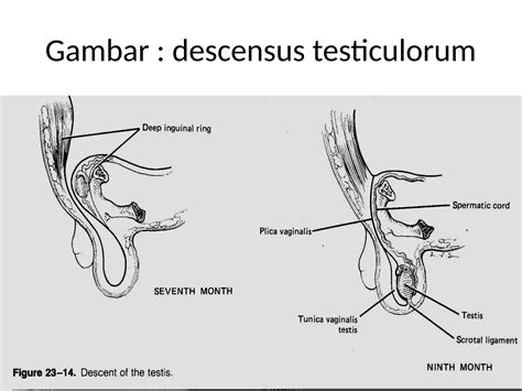 Abdomen Untuk Pembelajaran Mahasiwa Pptx
