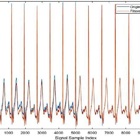 baseline drift elimination outcome download scientific diagram