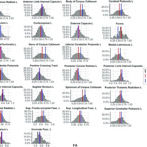 Histogram Of Fa Distribution The Histogram Represents The Frequency