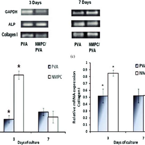 Semi Quantitative Reverse Transcriptase Pcr Analysis Of Alp And