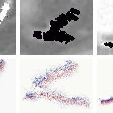 A Branching Points Between LCX And LAD For Three Patients With The Download Scientific