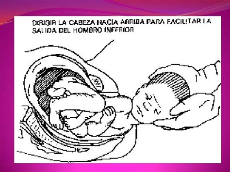 El Parto Y Sus Etapas