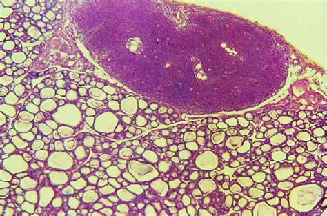 Thyroid And Parathyroid Slide Prepared Slides