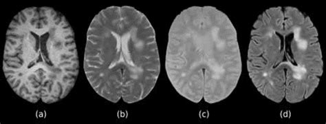 Github Ahmedsana Binary Class Brain Tumor Segmentation Using Unet We