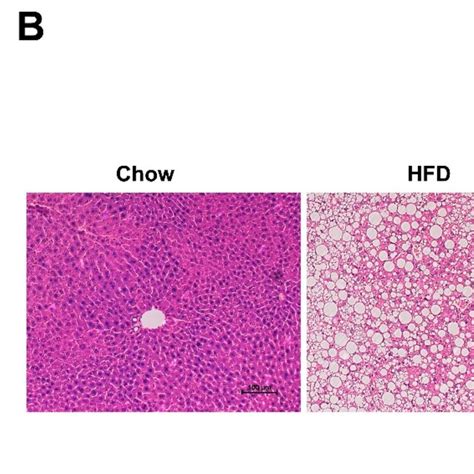 Ca Alleviates Hfd Induced Hepatic Lipid Accumulation A Liver Weight
