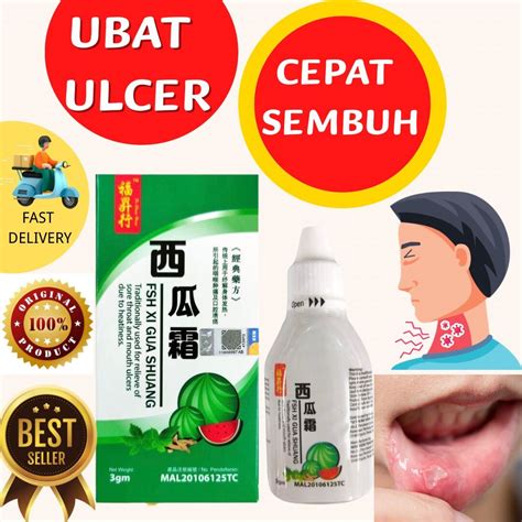 UBAT ULCER CEPAT SEMBUH SAKIT TEKAK RELIEVE ULCER 西瓜霜 舒缓口腔溃疡 喉咙发炎 Lazada