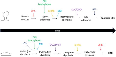 Differences In The Carcinogenesis Of Cac And Sporadic Crc