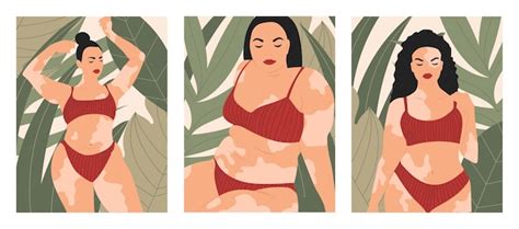 Illustration De Peau De Vitiligo Avec Des Personnes Le Concept De