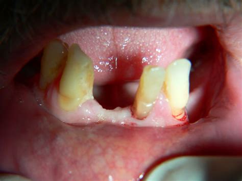 Dr Marlo Vinicios Duarte Lemos Cirurgião Dentista Odontologia
