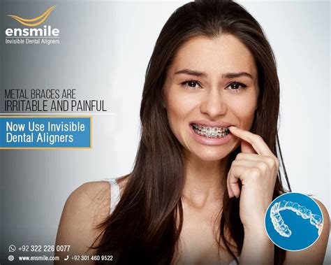 Best Invisible Aligners Wasinto