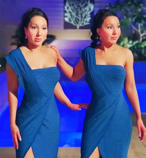 Worlds Most Identical Twins Pull Out Teeth At Same Time To Stay The