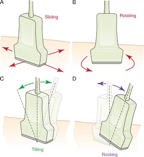 Point Of Care Ultrasound Clinical Tree