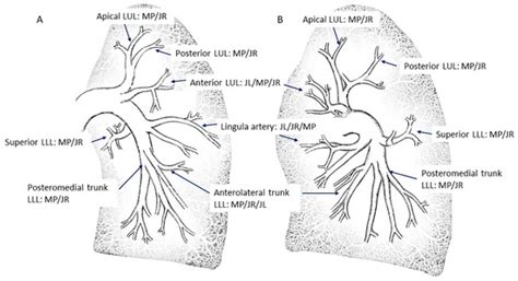 Pulmonary Artery Segmental Anatomy