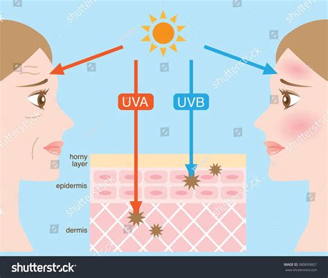 Infographic Skin Illustration Difference Between Uva Stock Vector Royalty Free