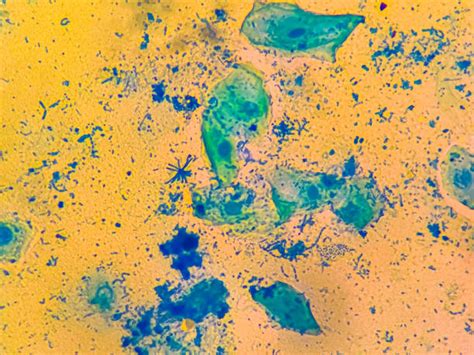 60 Enterococcus Faecium Foto Foto Stok Potret And Gambar Bebas Royalti