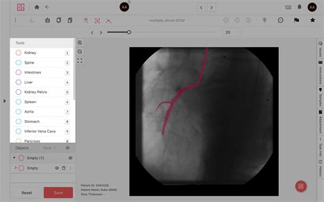 Dicom Labeling Editor Ango Hub Docs
