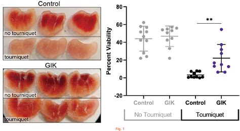 Figure 1 From Systemic Glucose Insulin Potassium Reduces Skeletal