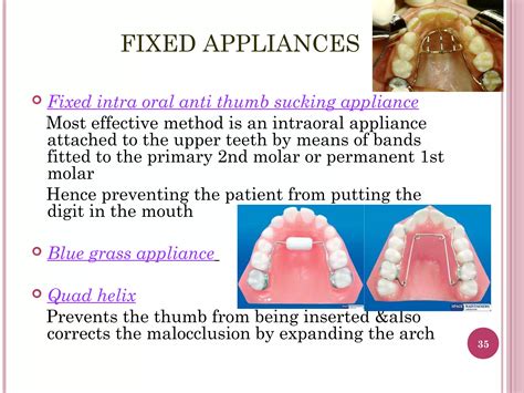 Oral Habits Pedodontics Ppt