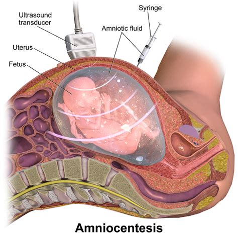 Understanding Pathology Test Results