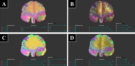 A Tractography Dataset With A Group Of Segmented Bundles Dataset Ii Download Scientific