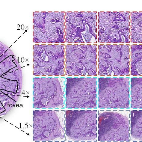 Inspiration Of Fovea Unet Left The Map Shows The Lnm Images From The Download Scientific