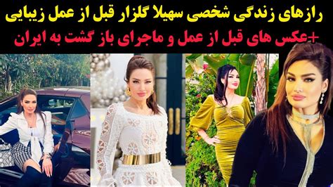 رازها زندگی شخصی سهیلا گلزار قبل از عمل زیبایی ؛پشت پرده جدایی سهیلا