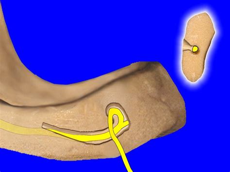 Dental Implantology Courses And Lectures Lateral Nerve Repositioning