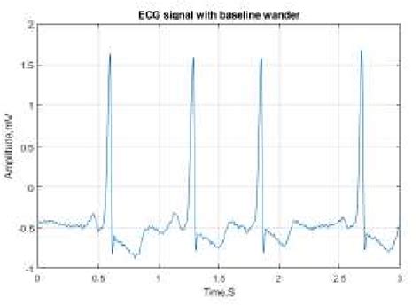 Figure 1 From Classification Of Cardiac Cycles Using A Convolutional