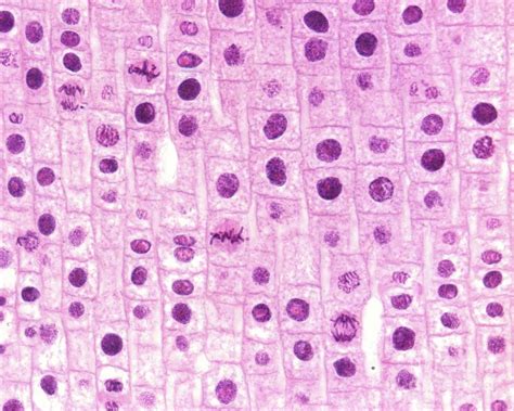 Anaphase Under Microscope