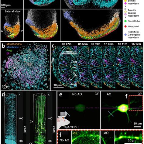 Adaptively Correcting For Sample Size And Aberrations When Using Download Scientific Diagram