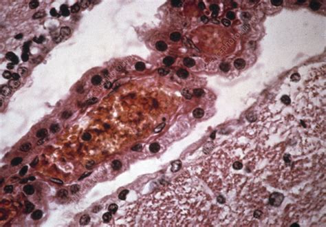 Choroid Plexus In Brain Stock Image P330 0311 Science Photo Library