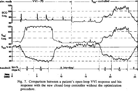 Figure 7 From Development Of A Closed Loop Pacemaker Controller