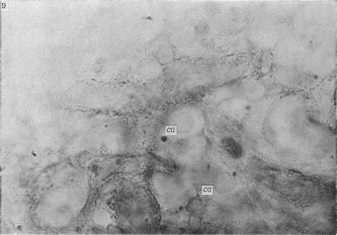 Shows The Glomus Cells Located Upon The Capillary Walls Cg Glomus