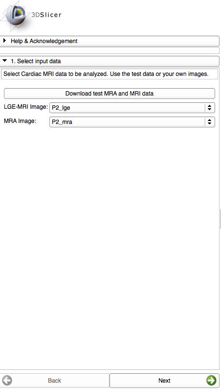 documentation nightly modules lasegmentationworkflow slicer wiki