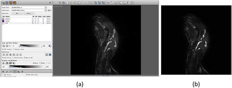 Csf Quantification Experiment On Rabbit A Segmentation Result By