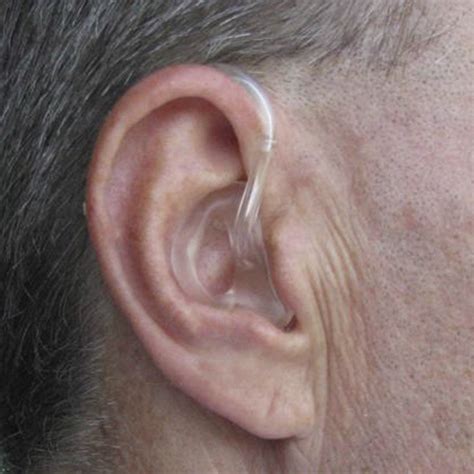 Hearing Aid Ear Mold Kit At Cynthia Fagan Blog